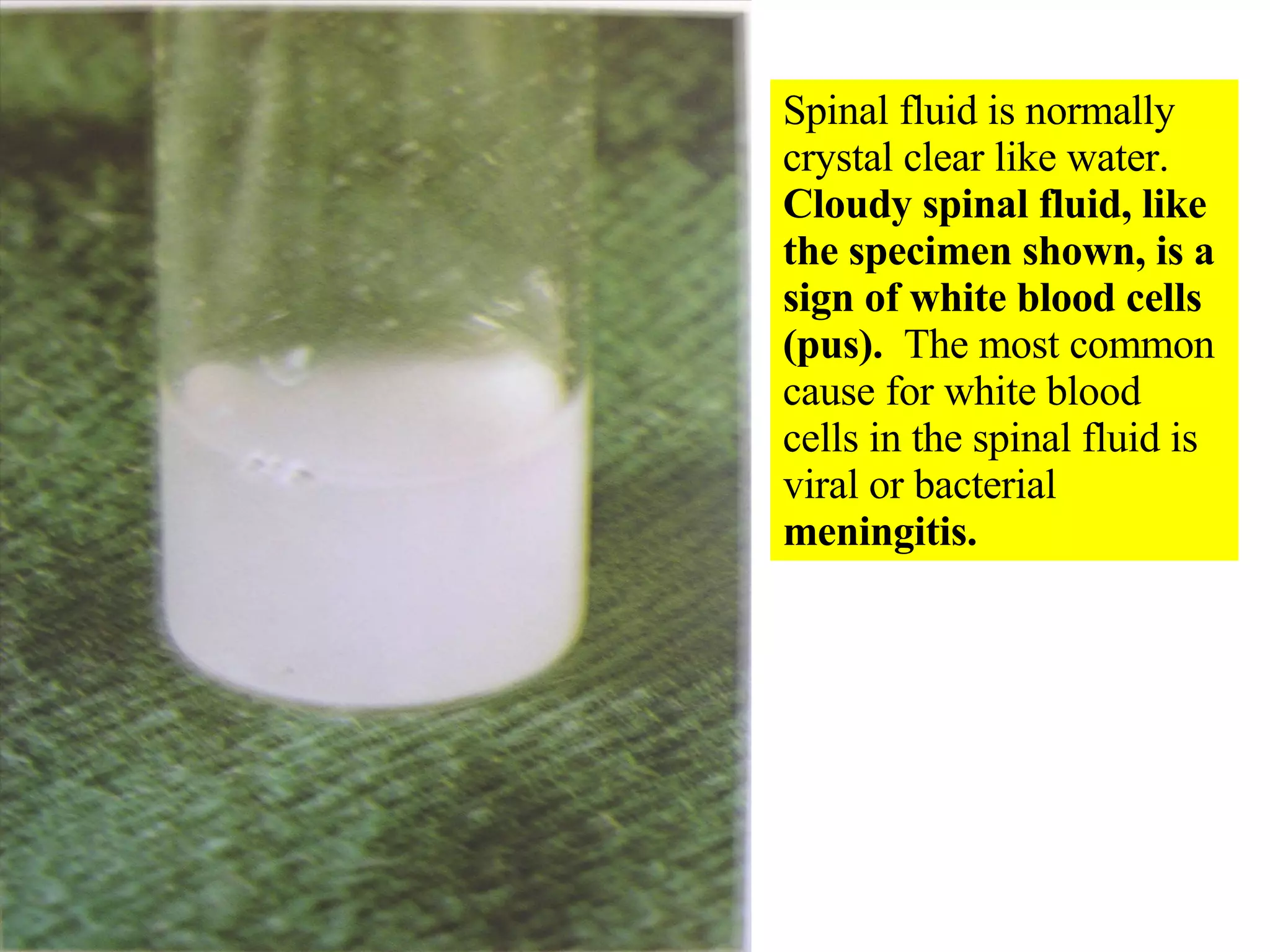 16 Spinal Cord And Spinal Nerves | PPT