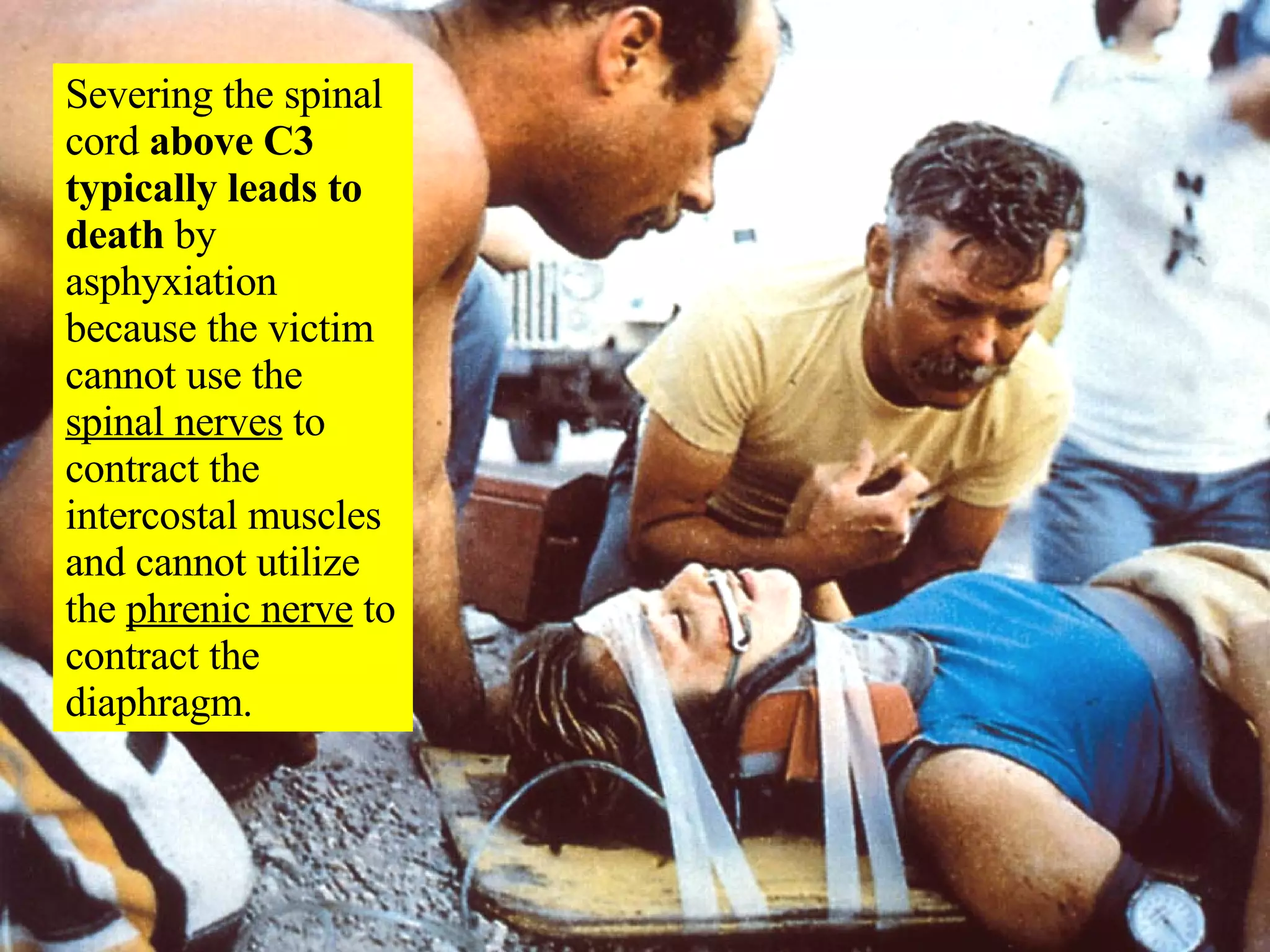 16 Spinal Cord And Spinal Nerves | PPT