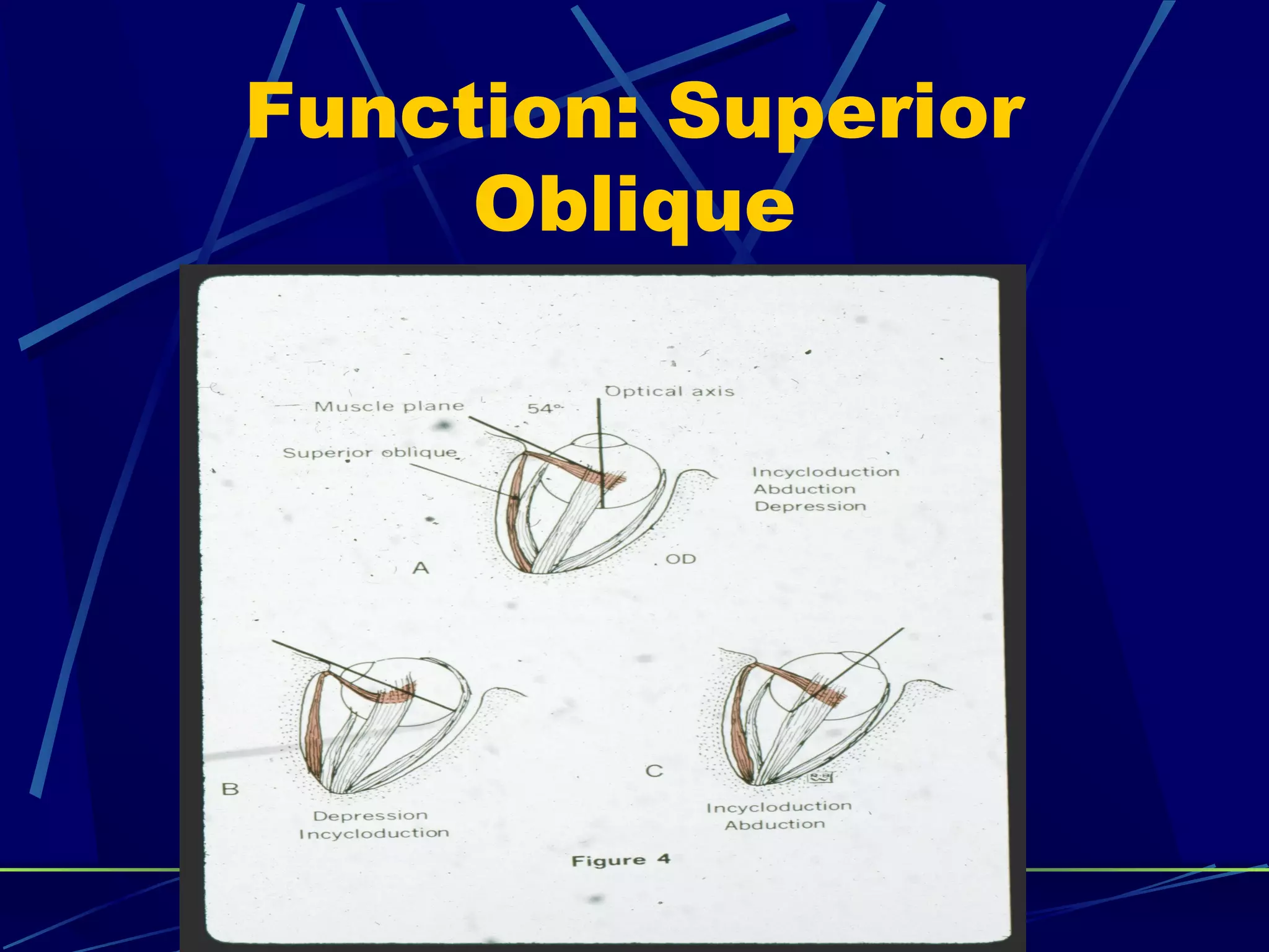 16 superior oblique palsy | PPT