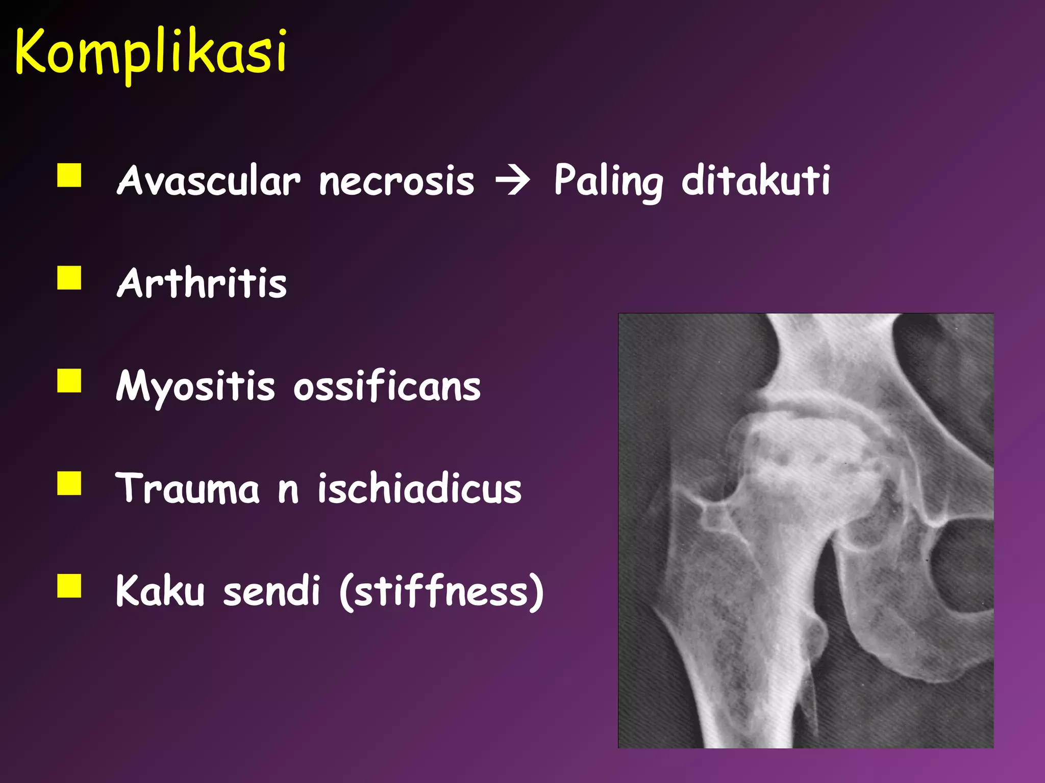 16 trauma-sendi-10-april-2013 | PPT