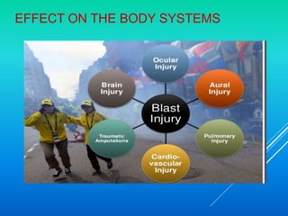 blast injury | PPTX