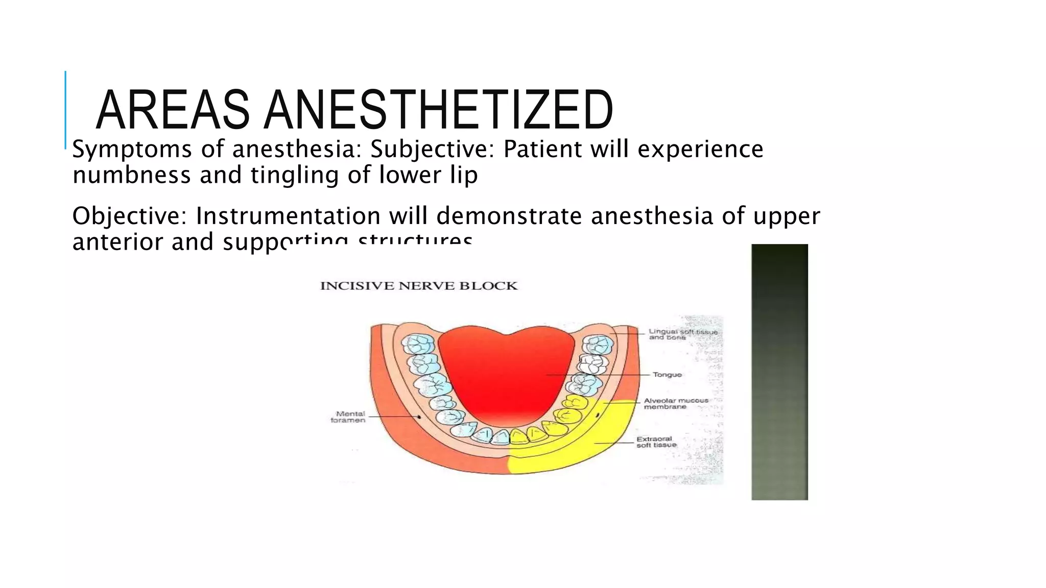 Mandibular Nerve Blocks.pptx