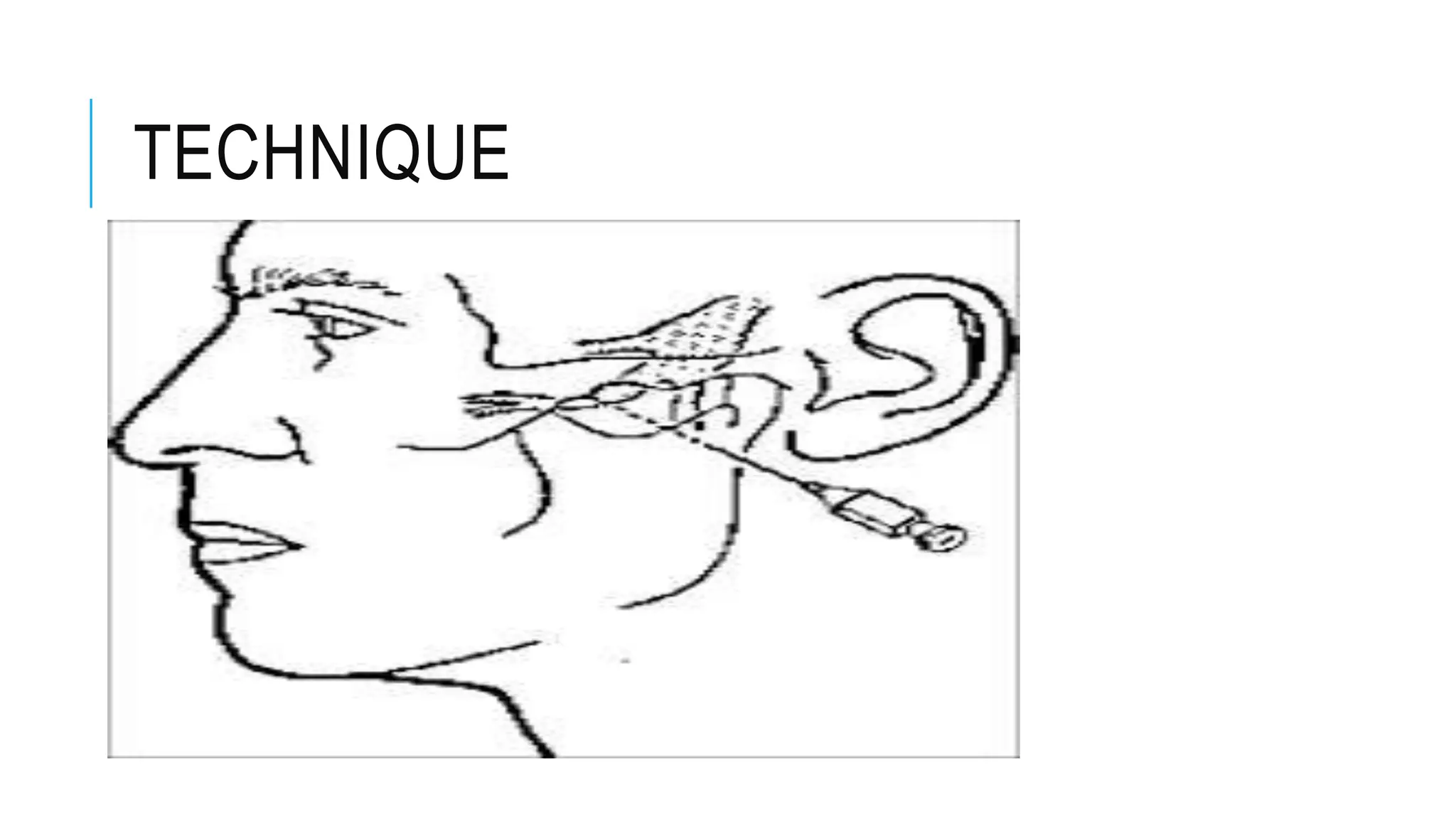 Mandibular Nerve Blocks Pptx