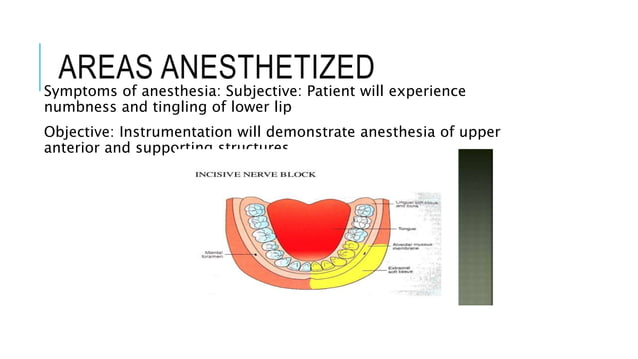 Mandibular Nerve Blocks Pptx