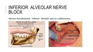 Mandibular Nerve Blocks.pptx