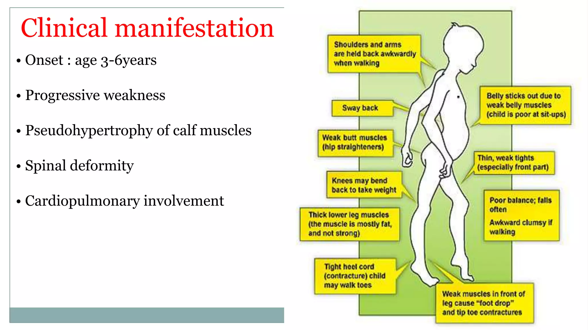 Muscular Dystrophy disorder PPT | PPTX