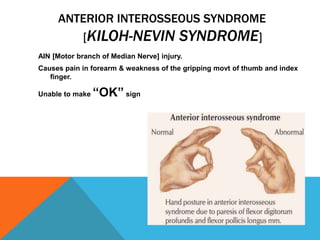 Peripheral nerve injuries Dr Aditya shrimal | PPTX