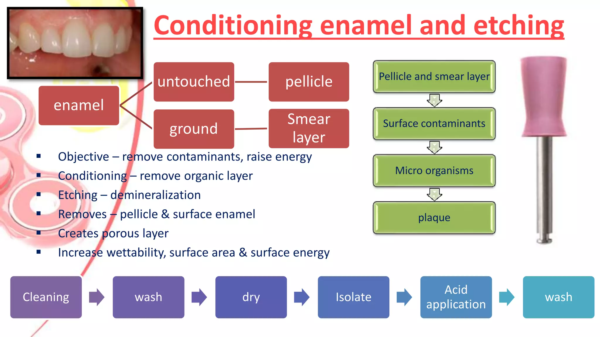 dentin bonding agents | PPTX
