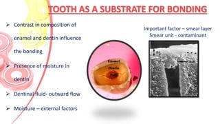 dentin bonding agents | PPTX