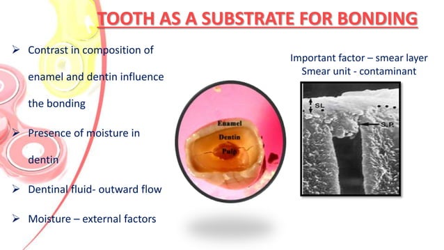 dentin bonding agents | PPTX | Dental Health | Diseases and Conditions