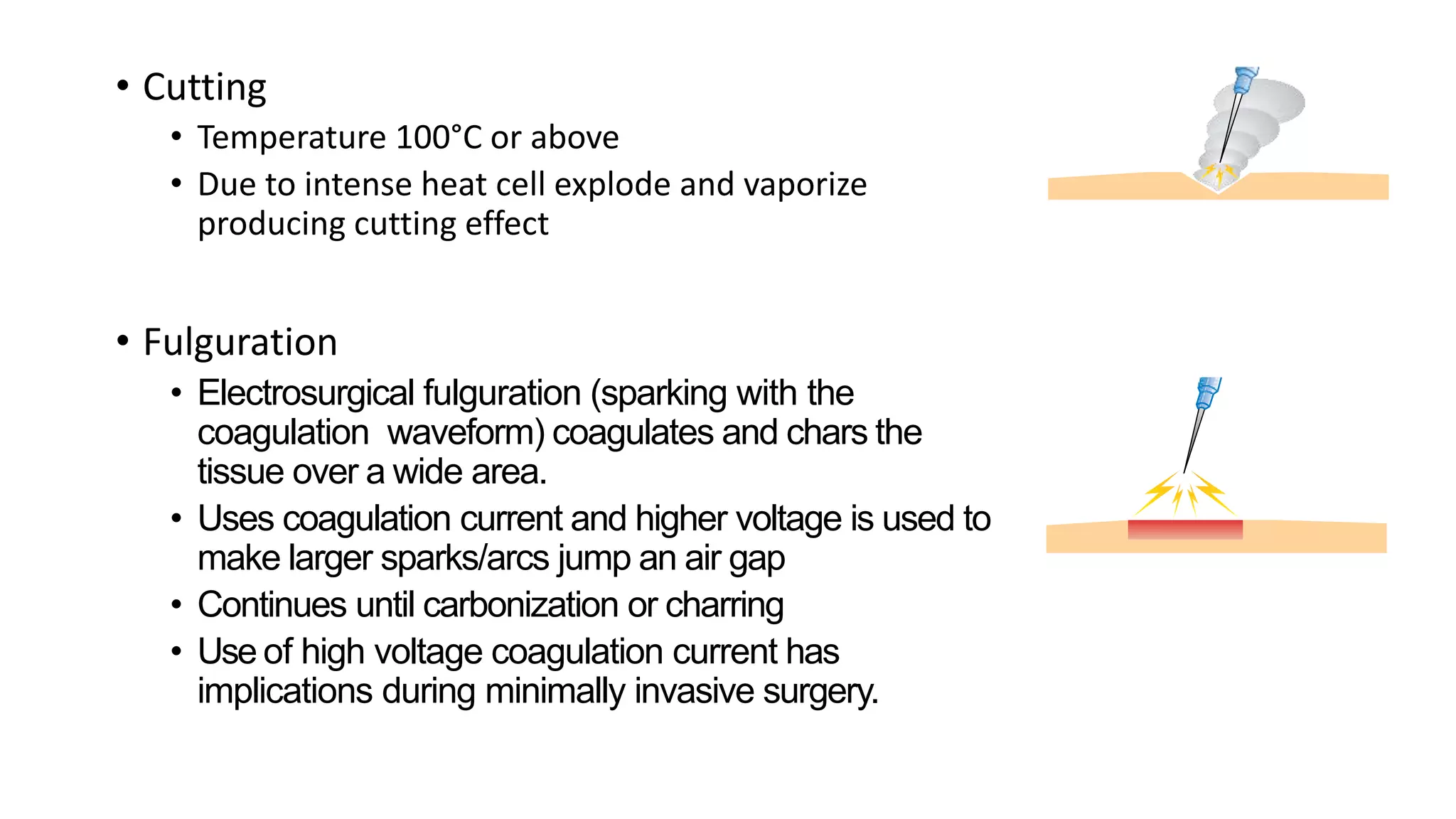 Diathermy principles and types | PPTX