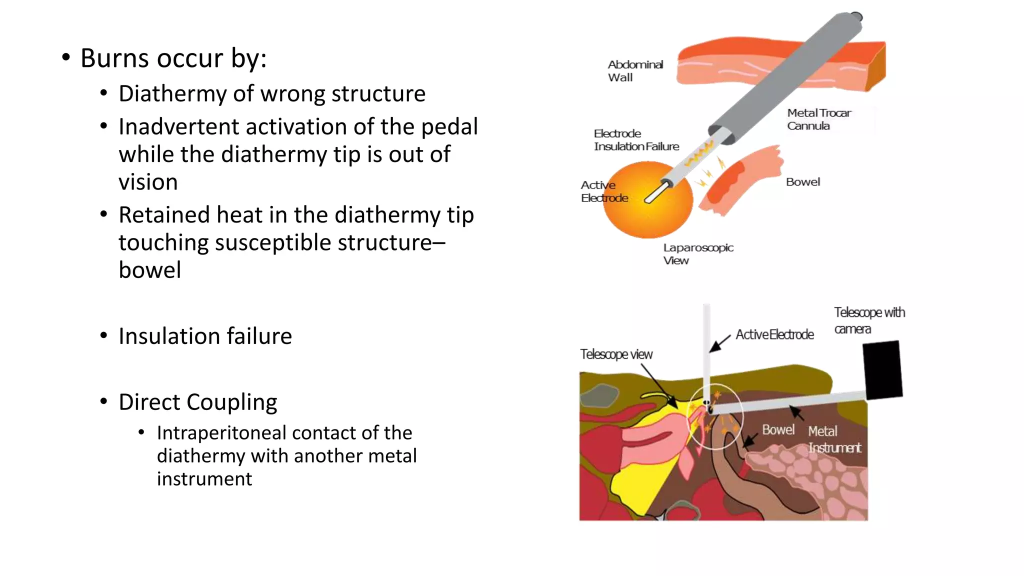 Diathermy principles and types | PPTX