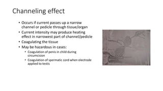 Diathermy principles and types | PPTX