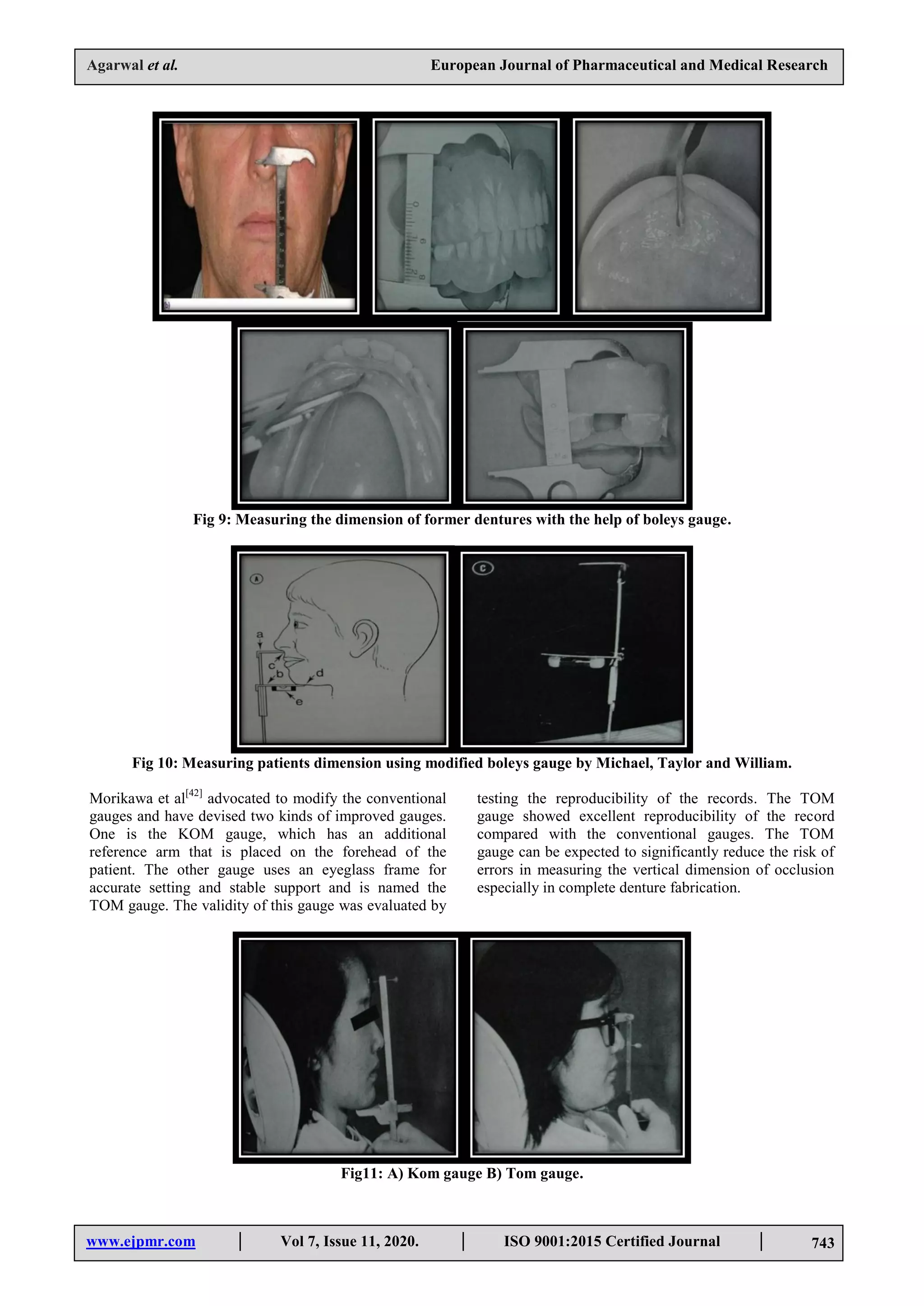 PRE-EXTRACTION RECORDS ARE RELIABLE TOOL FOR COMPLETE DENTURE ...