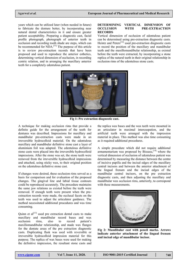 PRE-EXTRACTION RECORDS ARE RELIABLE TOOL FOR COMPLETE DENTURE ...