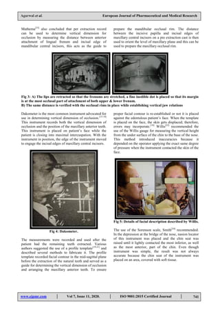 PRE-EXTRACTION RECORDS ARE RELIABLE TOOL FOR COMPLETE DENTURE ...