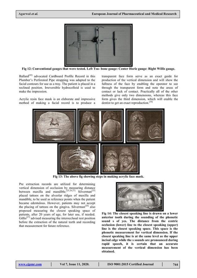 PRE-EXTRACTION RECORDS ARE RELIABLE TOOL FOR COMPLETE DENTURE ...
