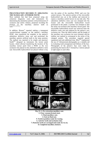 PRE-EXTRACTION RECORDS ARE RELIABLE TOOL FOR COMPLETE DENTURE ...