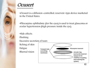 Implant infusion pump & ophthalmic inserts. | PPT