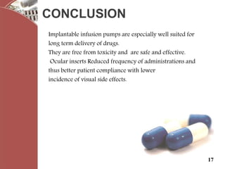 Implant infusion pump & ophthalmic inserts. | PPT