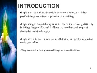 Implant infusion pump & ophthalmic inserts. | PPT