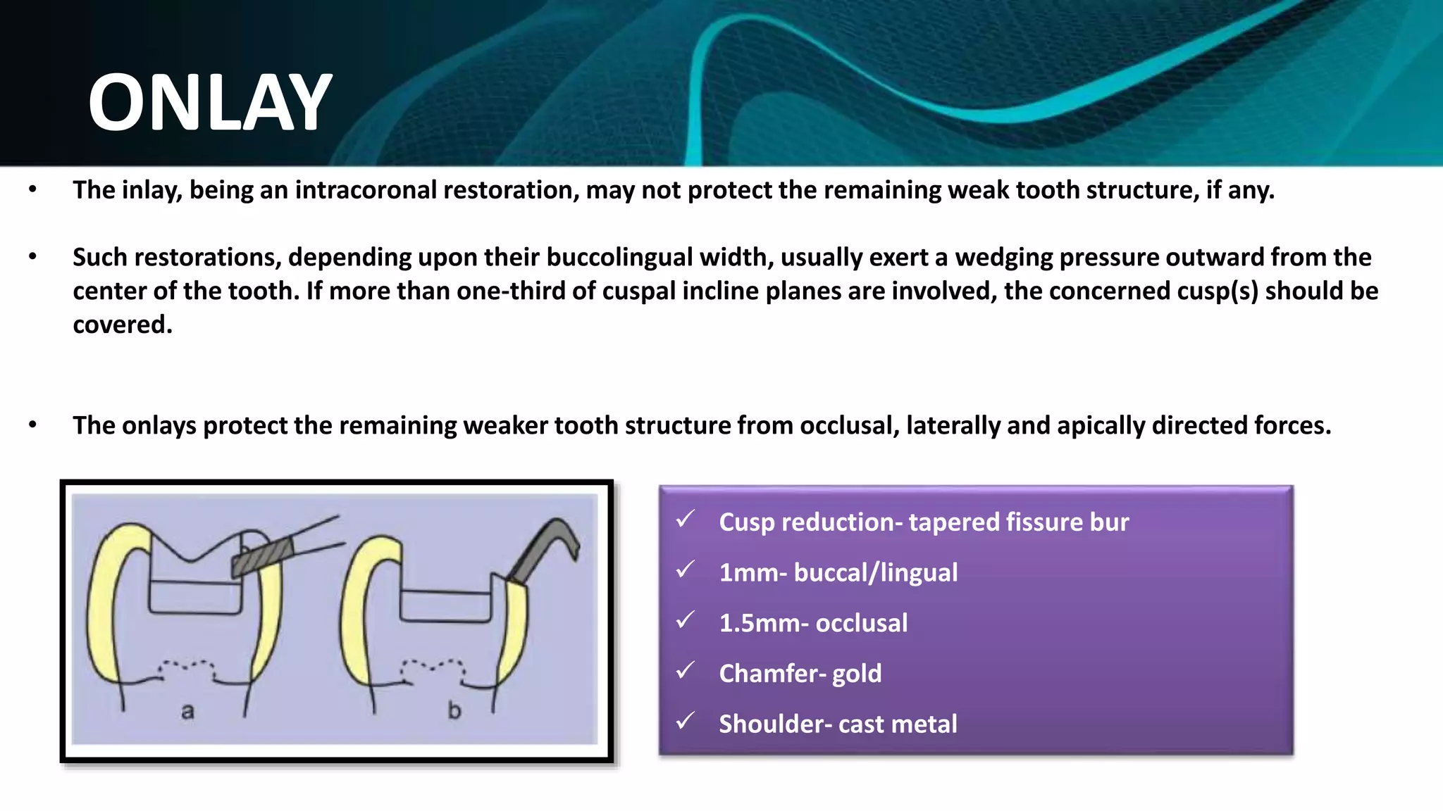 indirect restorations | PPTX