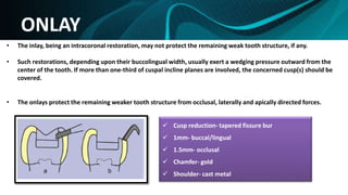 indirect restorations | PPTX