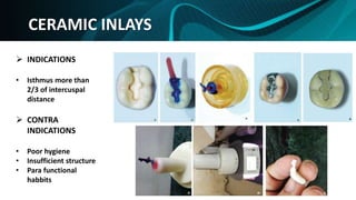 indirect restorations | PPTX