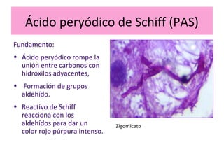 160836304 diagnostico-histologico-de-micosis-finished | PPT
