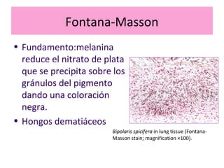 160836304 diagnostico-histologico-de-micosis-finished | PPT