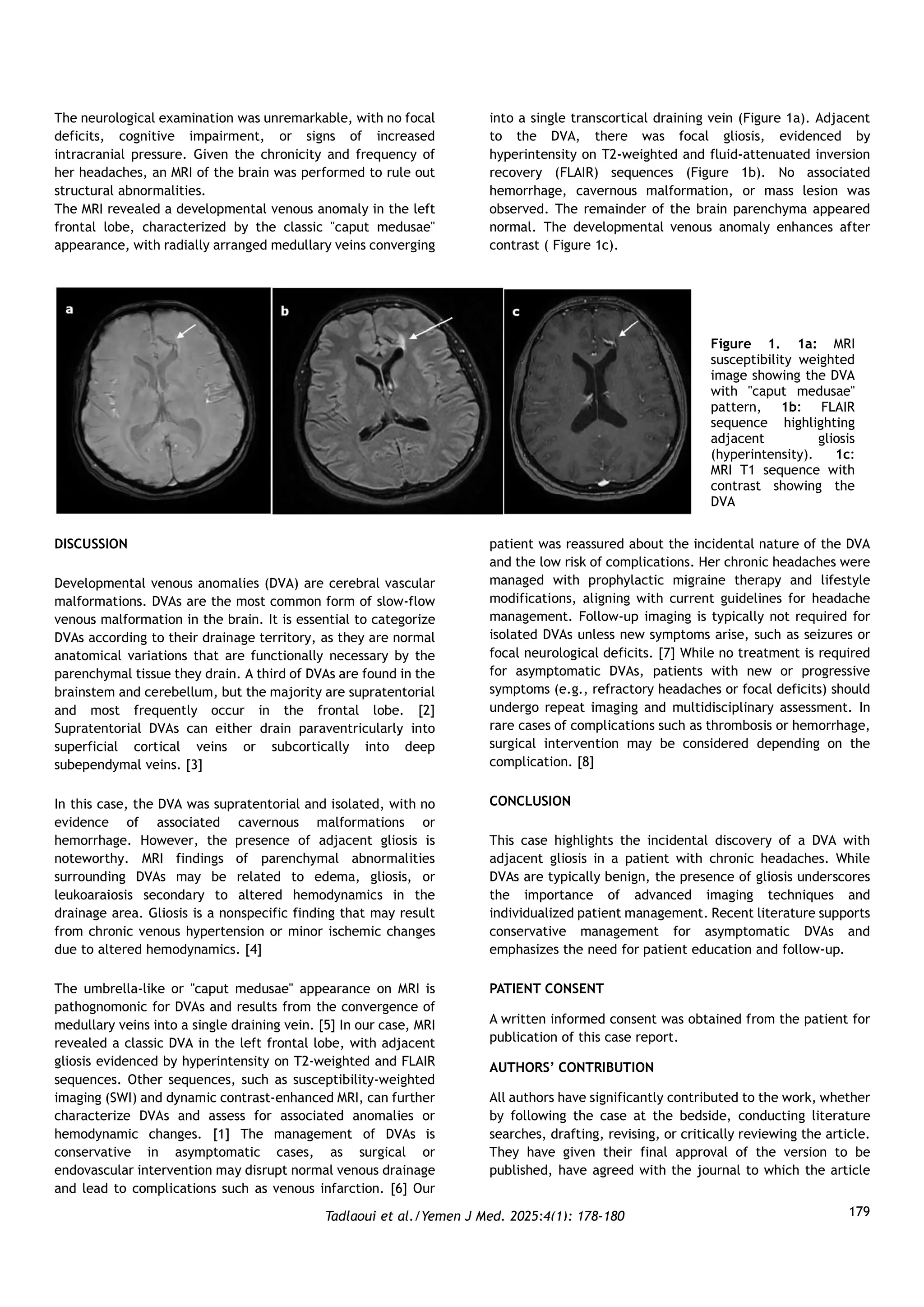 Incidental Discovery of a Developmental Venous Anomaly: A Case Report ...