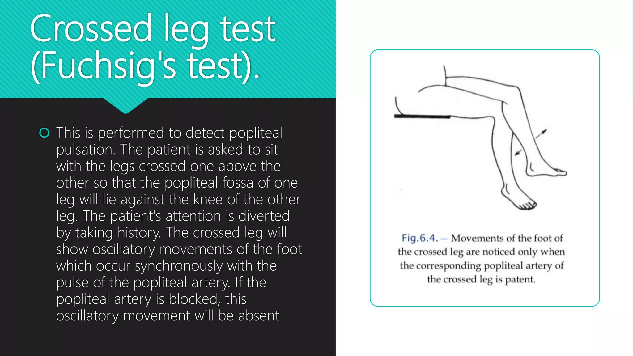 Peripheral Vascular Disease Case Presentation | PPTX