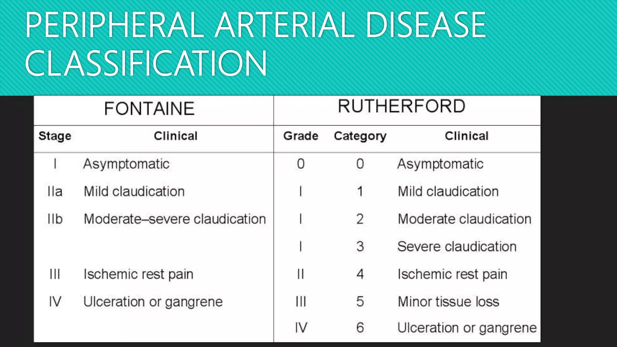 Peripheral Vascular Disease Case Presentation | PPTX