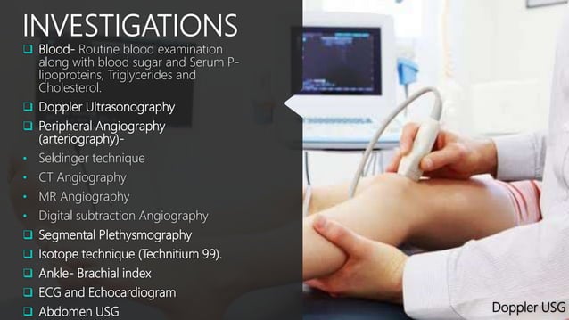 Peripheral Vascular Disease Case Presentation | PPTX