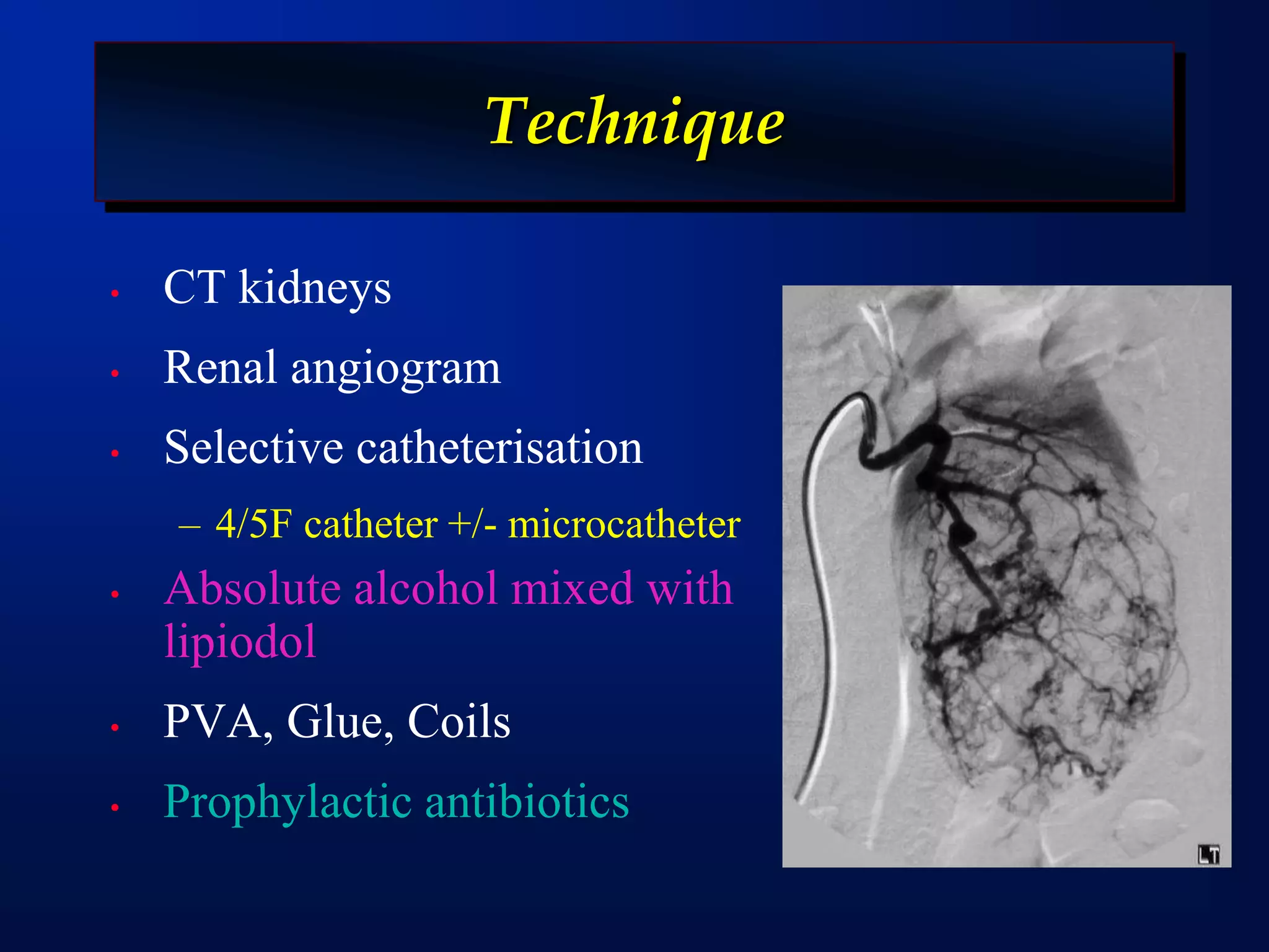 Angiomyolipoma | PPTX