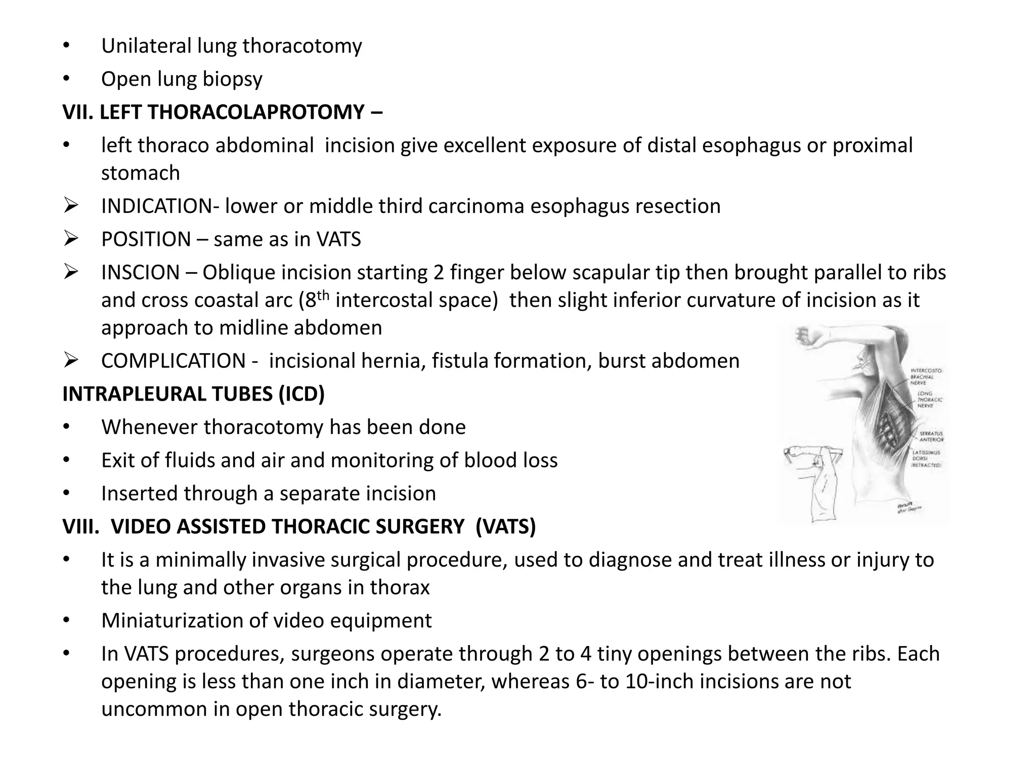thoracic surgery | PPTX