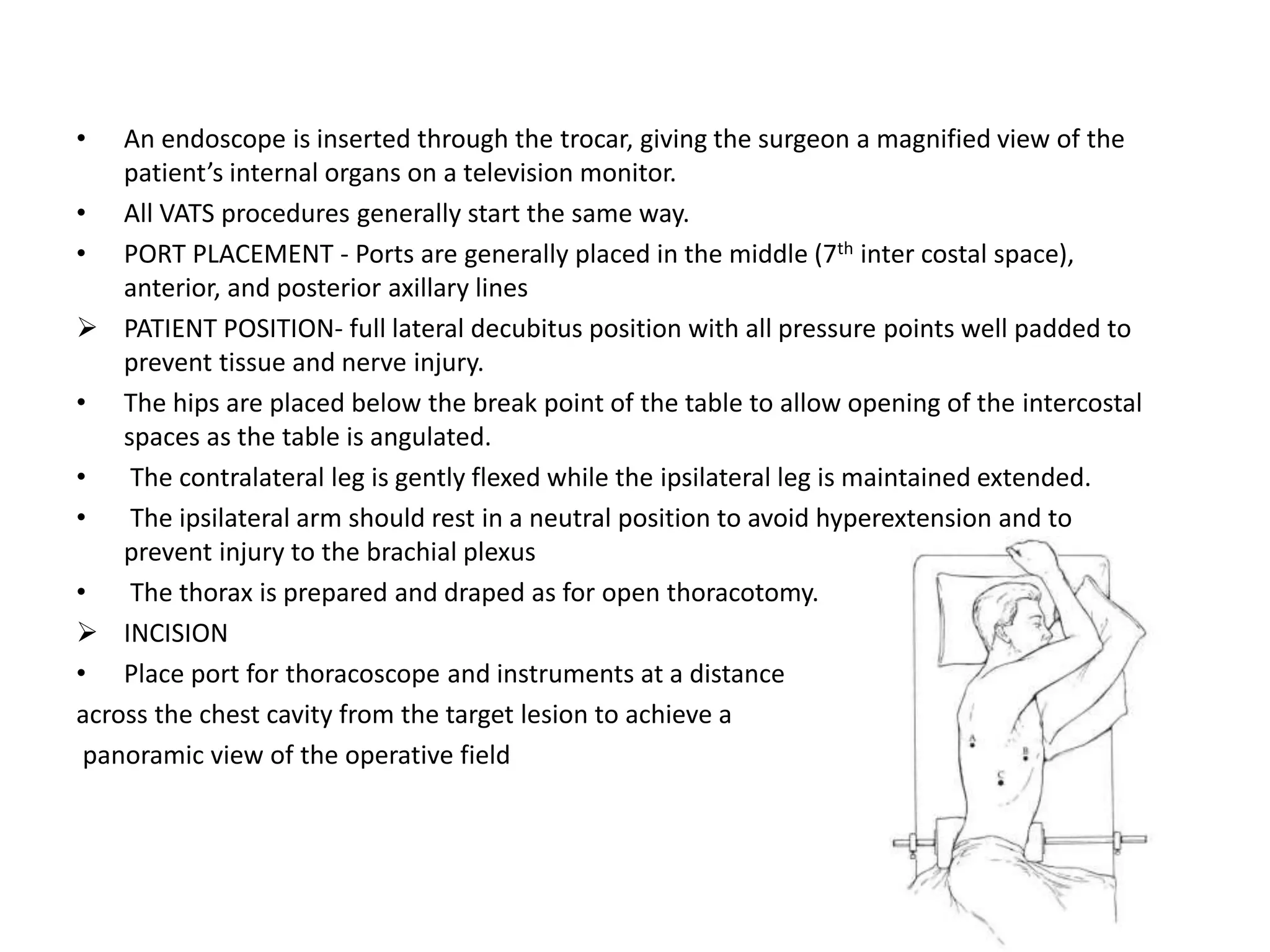 thoracic surgery | PPTX
