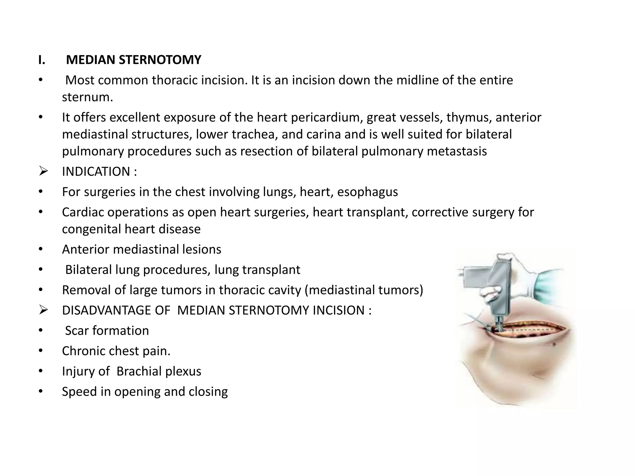 thoracic surgery | PPTX