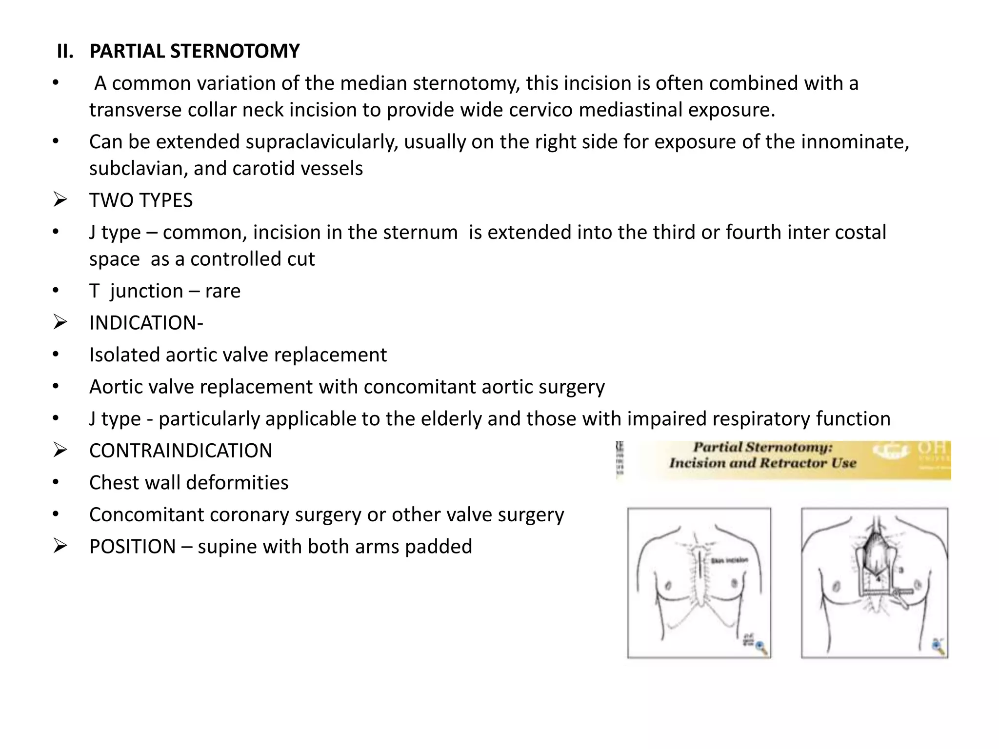 thoracic surgery | PPTX