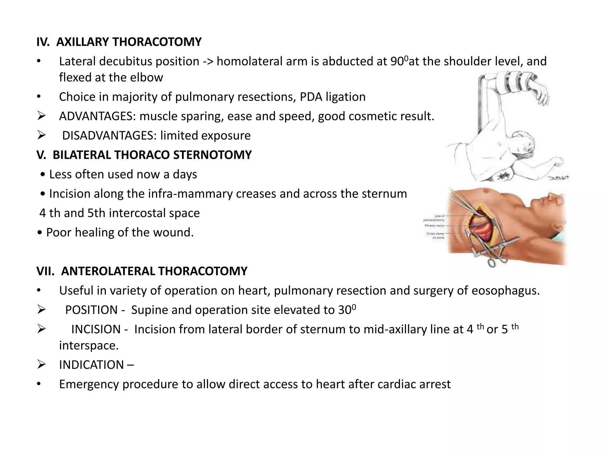 thoracic surgery | PPTX