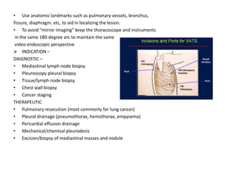 thoracic surgery | PPTX