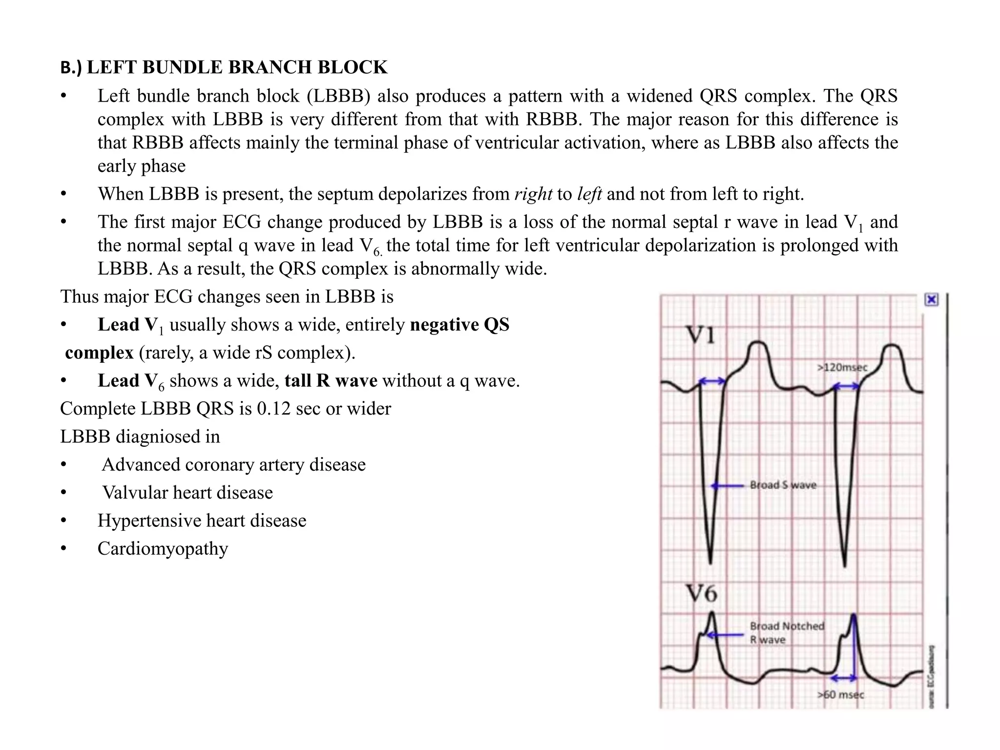 cases of ecg interpretation | PPTX