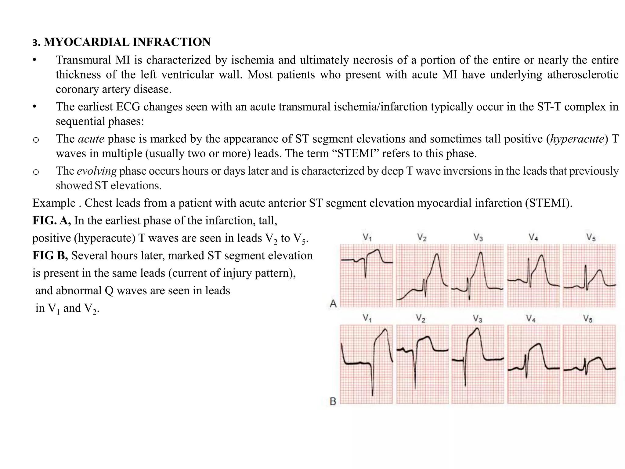 cases of ecg interpretation | PPTX