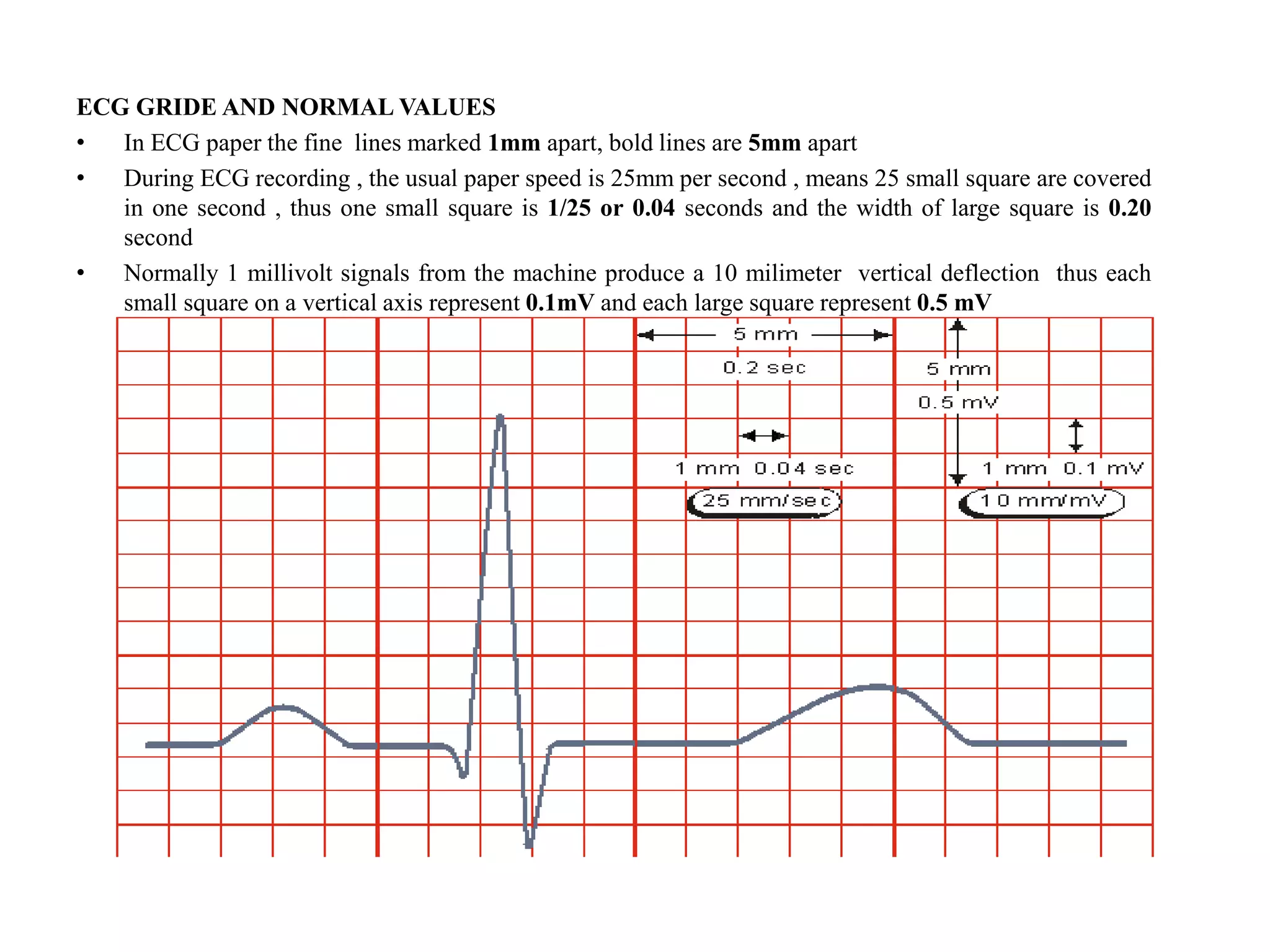 cases of ecg interpretation | PPTX