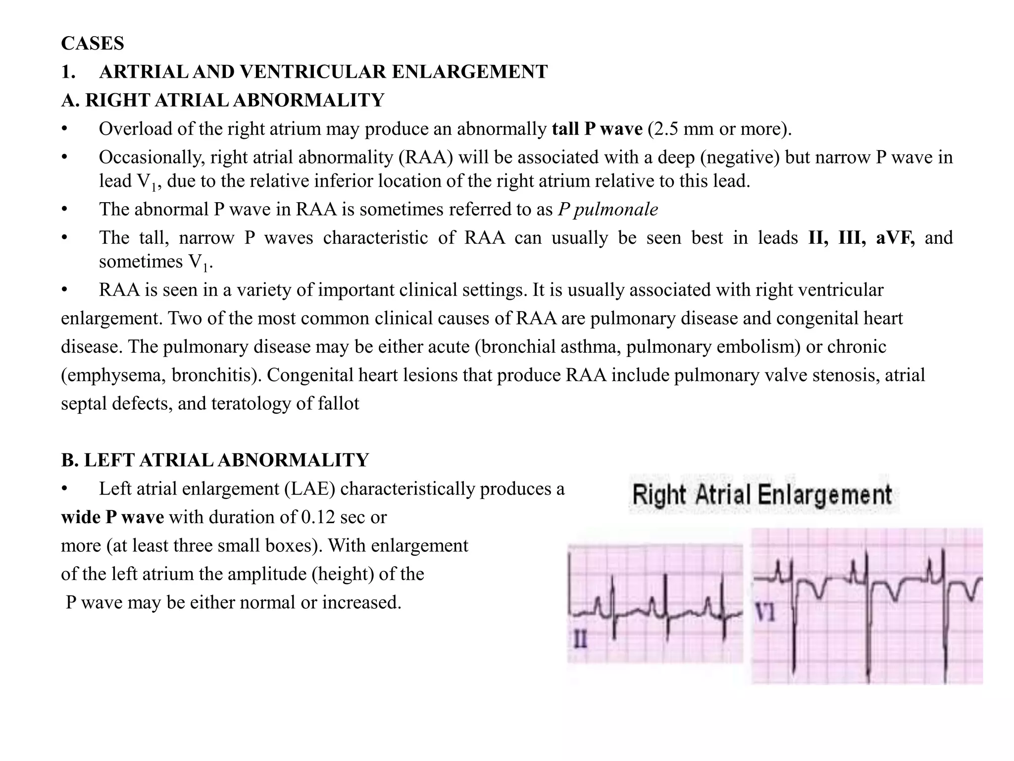 cases of ecg interpretation | PPTX