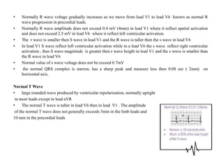 cases of ecg interpretation | PPTX