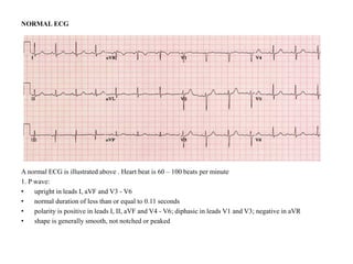 cases of ecg interpretation | PPTX