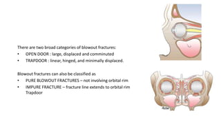 161992-brain-template-16x9.pptx