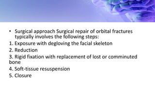 161992-brain-template-16x9.pptx