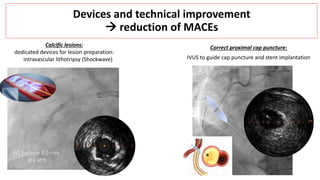 Alessio Mattesini: How to reduce periprocedural MACE rate in CTO PCI ...